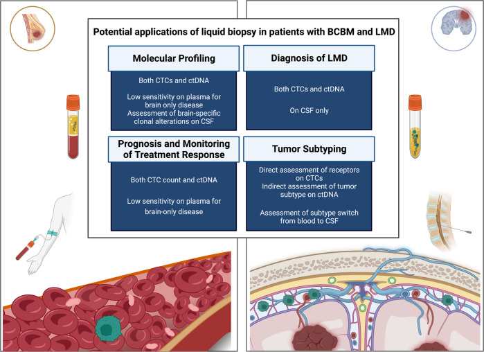 Liquid biopsy for brain metastases and leptomeningeal disease in patients with breast cancer - PMC