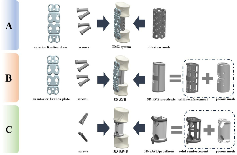 An innovative self-stabilised 3D-printed artificial vertebral body designed for clinical ...