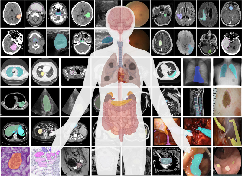 Segment anything in medical images - PMC
