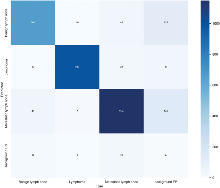 Diagnosis of cervical lymphoma using a YOLO-v7-based model with ...