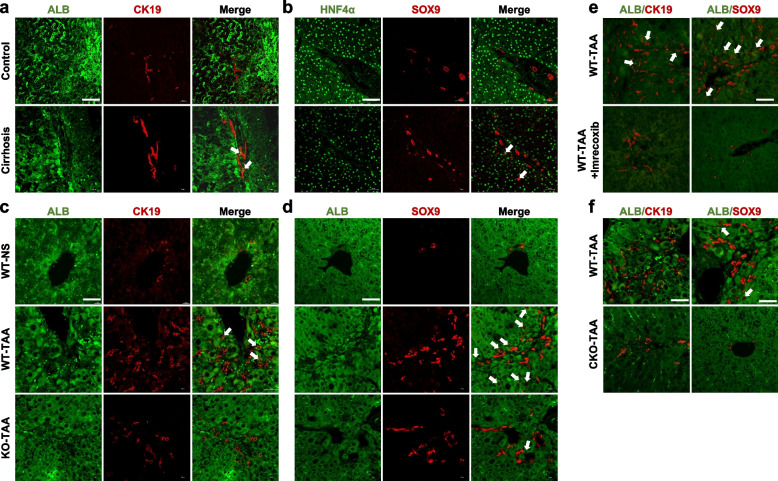 Atypical Cholangiocytes Derived From Hepatocyte Cholangiocyte