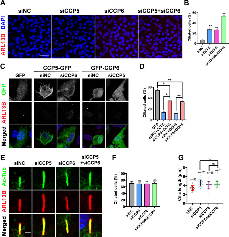CCP5 and CCP6 retain CP110 and negatively regulate ciliogenesis - PMC