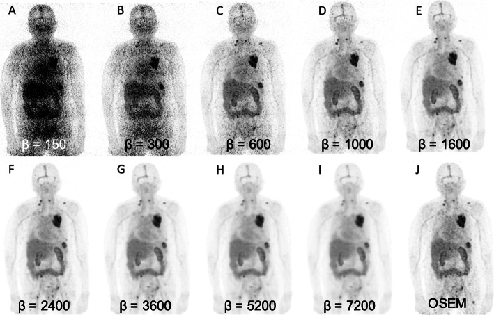 Improved image reconstruction of 89Zr-immunoPET studies using a Bayesian penalized likelihood ...