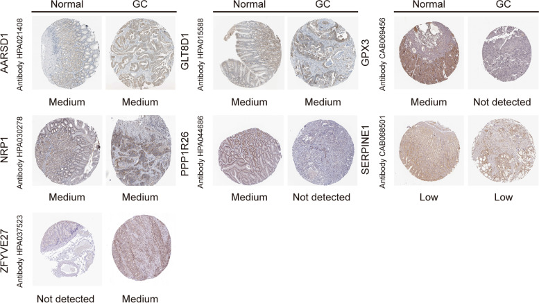 Integrated Single Cell And Bulk Rna Sequencing Analysis Identifies A