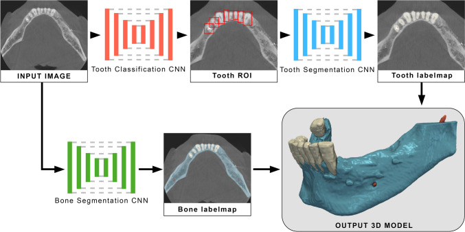 Assessment of hard tissue changes after horizontal guided bone regeneration with the aid of deep ...