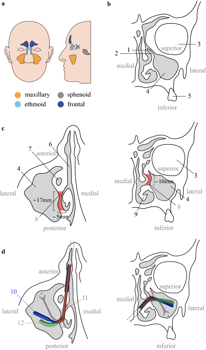 A miniature robotic steerable endoscope for maxillary sinus surgery called PliENT - PMC