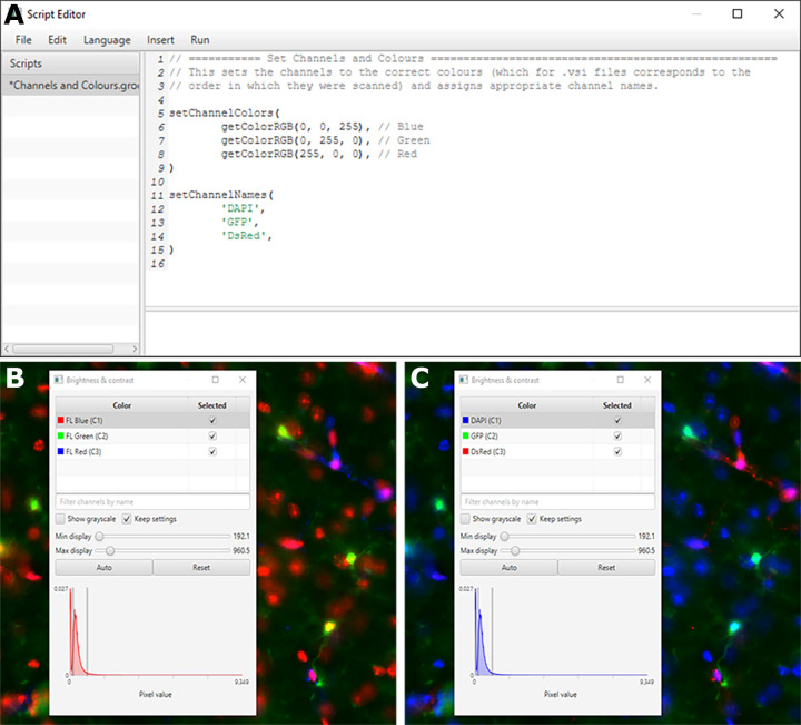 Automated Quantification of Multiple Cell Types in Fluorescently Labeled Whole Mouse Brain ...