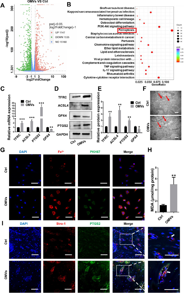 Outer membrane vesicles of Porphyromonas gingivalis impede bone ...