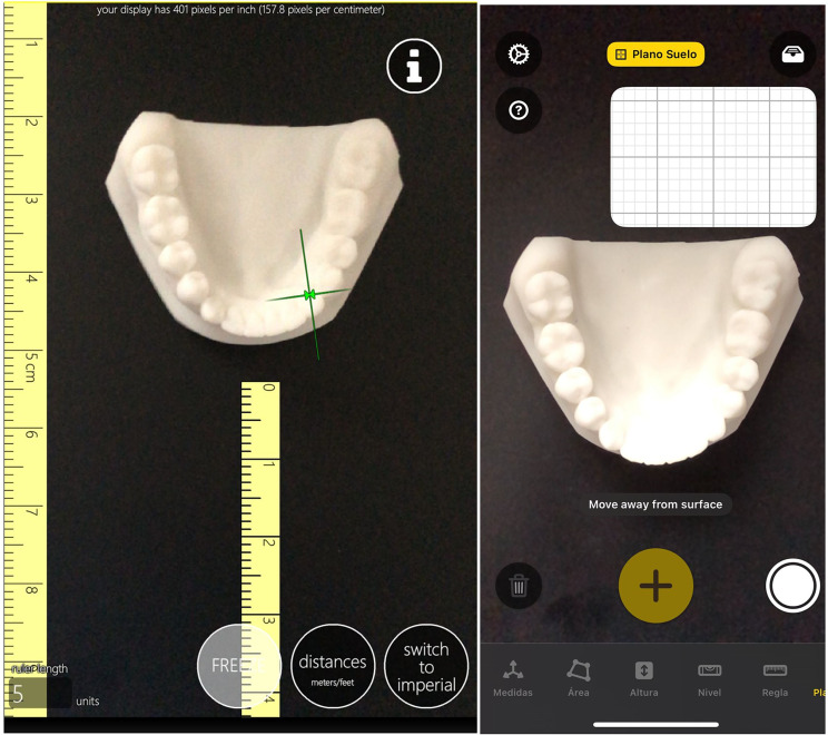 Reproducibility and reliability of dental arch measurements: comparing ...