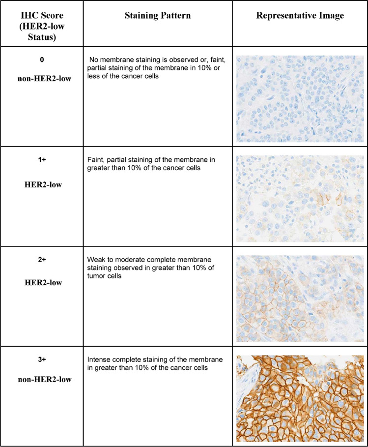 Analytical and clinical validation of PATHWAY Anti-HER-2/neu (4B5) antibody to assess HER2-low ...