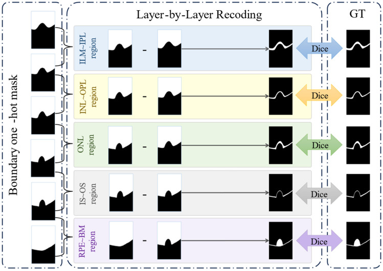 Boundary-Repairing Dual-Path Network for Retinal Layer Segmentation in OCT Image with Pigment ...