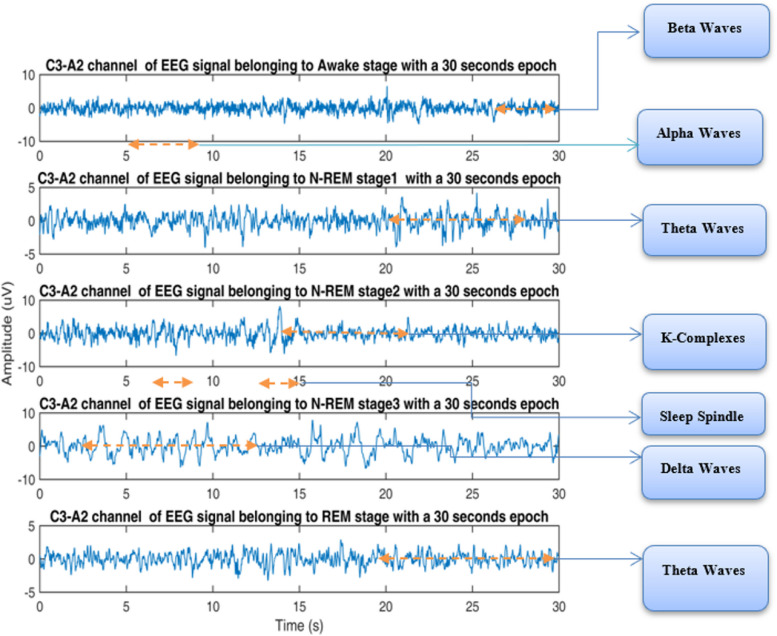 Machine learning-empowered sleep staging classification using multi-modality signals - PMC