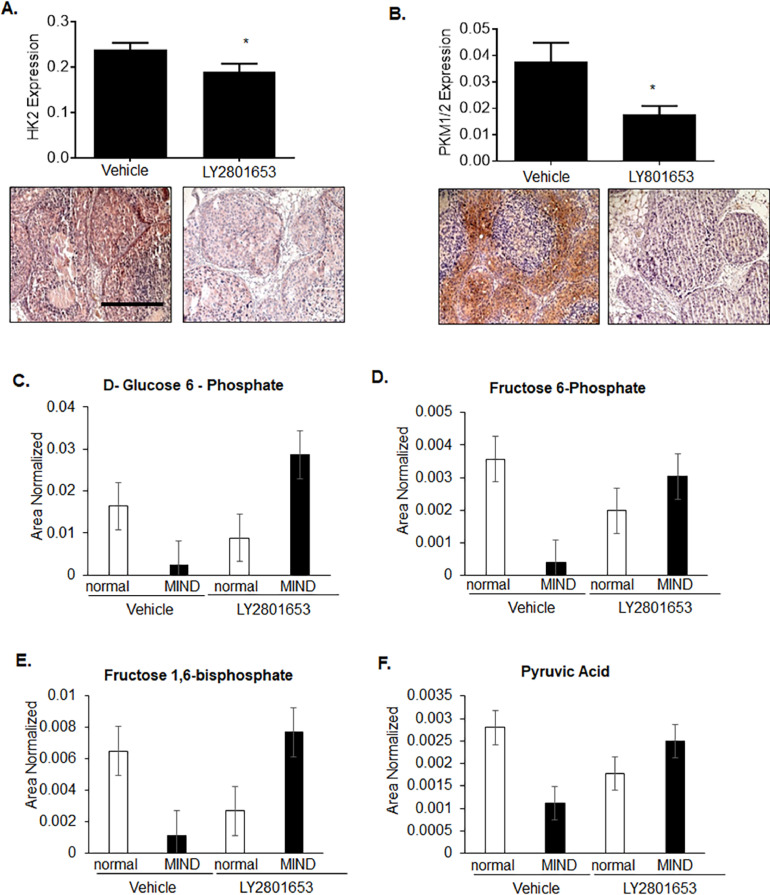 Regulation Of Growth Invasion And Metabolism Of Breast Ductal