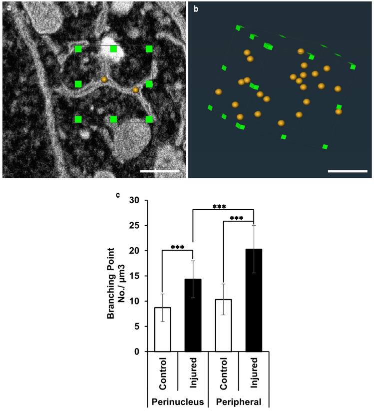 Dynamic changes in endoplasmic reticulum morphology and its contact ...