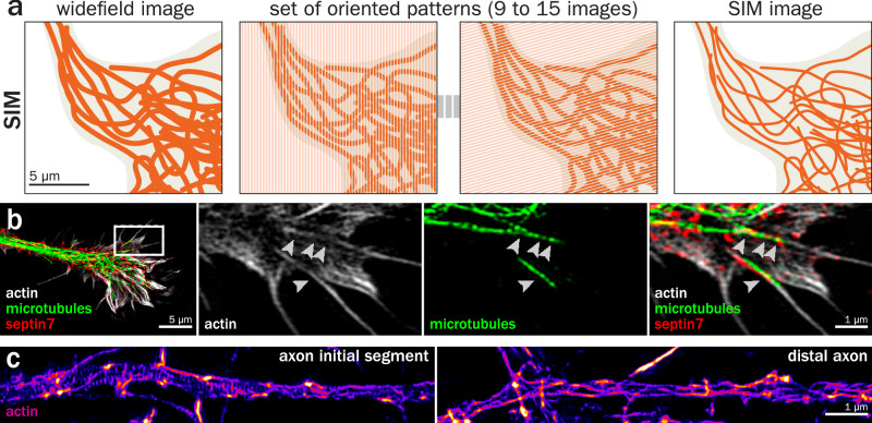 Super-resolution imaging of the neuronal cytoskeleton - PMC