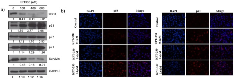 Anti-tumor efficacy of Selinexor (KPT-330) in gastric cancer is dependent on nuclear ...
