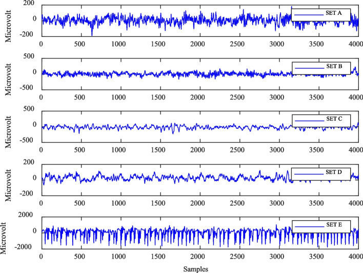 A hybrid CNN-Bi-LSTM model with feature fusion for accurate epilepsy ...