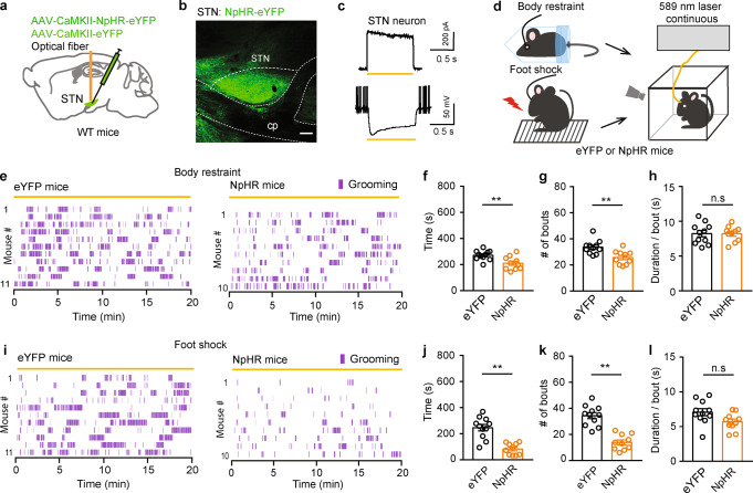 A subthalamo-parabrachial glutamatergic pathway is involved in stress-induced self-grooming in ...