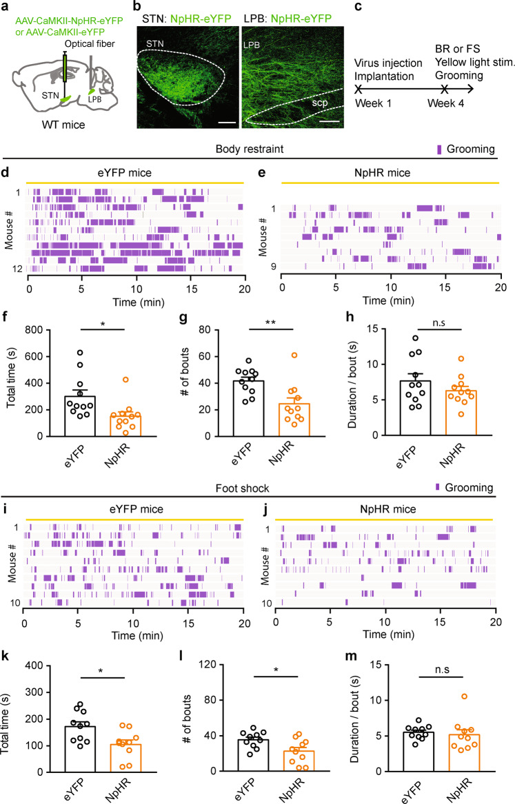 A subthalamo-parabrachial glutamatergic pathway is involved in stress-induced self-grooming in ...