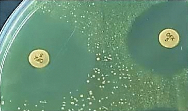 Thymoquinone’ potent impairment of multidrug-resistant Staphylococcus aureus NorA efflux pump ...