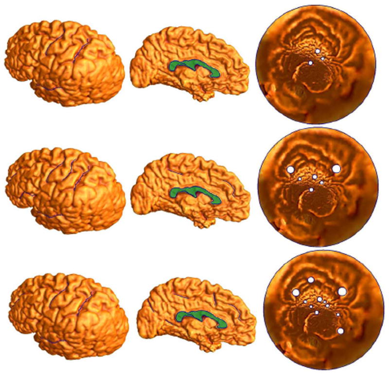 BRAIN SURFACE CONFORMAL PARAMETERIZATION WITH THE RICCI FLOW - PMC