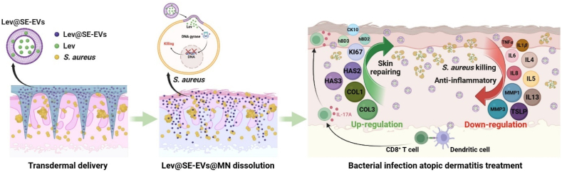 Microneedle delivery platform integrated with Staphylococcus epidermidis-derived extracellular ...