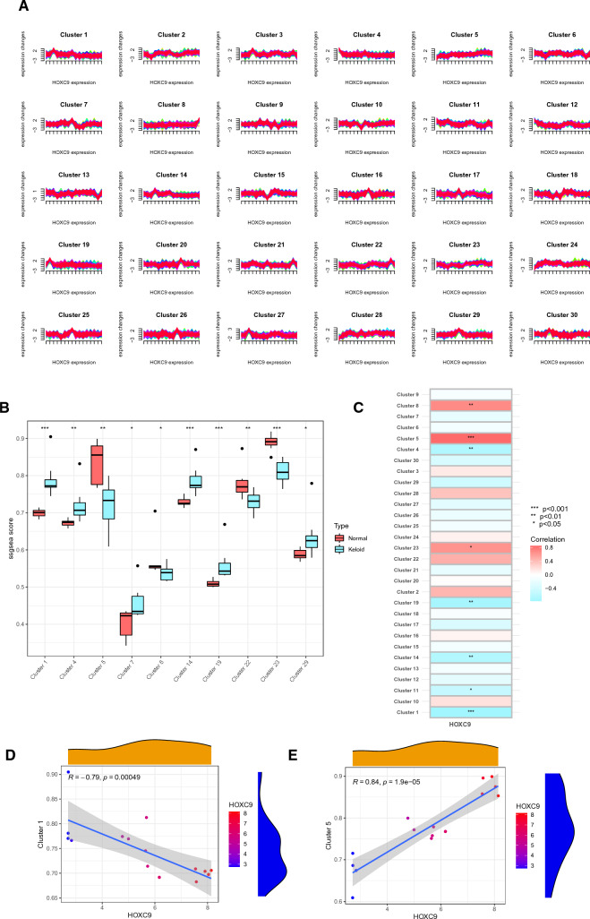 Identification of a potential bioinformatics-based biomarker in keloids and its correlation with ...