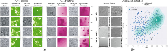 Learning deep features for dead and living breast cancer cell classification without staining - PMC