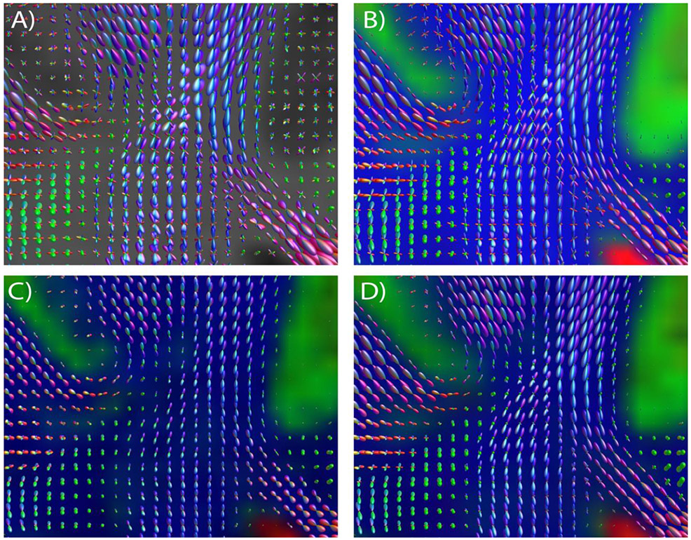 Deep Learning Estimation of Multi-Tissue Constrained Spherical Deconvolution with Limited Single ...