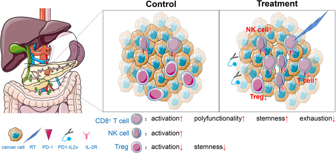 Bispecific immune molecule PD1-IL2v: a new therapeutic strategy for pancreatic ductal ...
