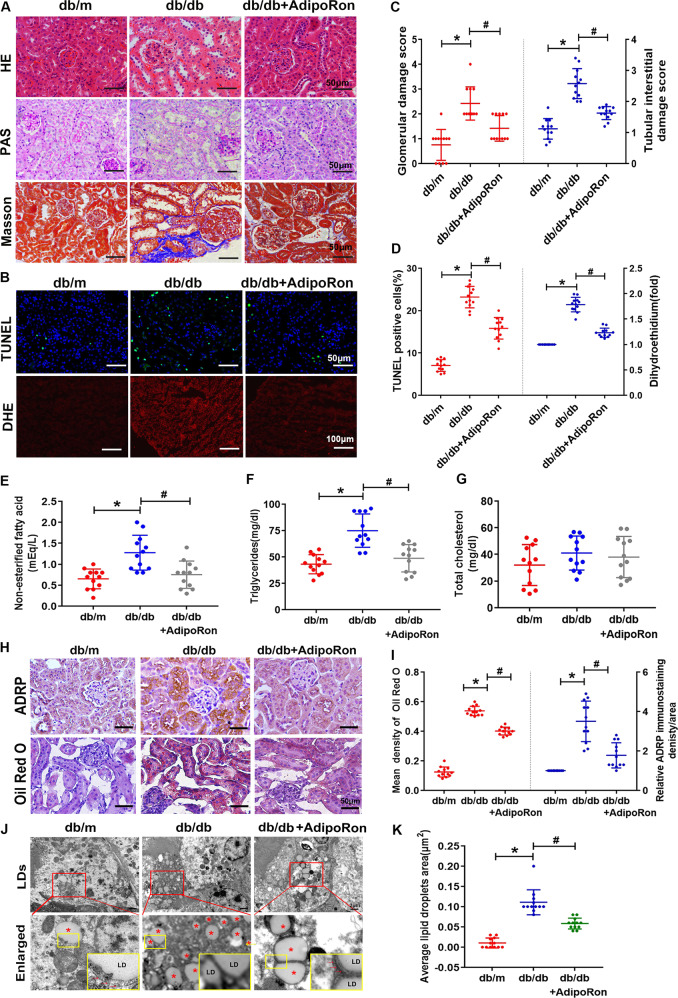 Lipophagy deficiency exacerbates ectopic lipid accumulation and tubular ... Lipophagy deficiency exacerbates ectopic lipid accumulation and tubular ...