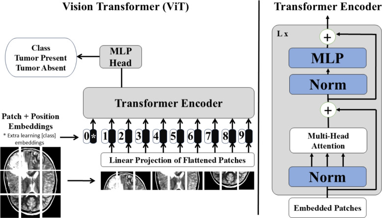 Hybrid model integration with explainable AI for brain tumor diagnosis: a unified approach to ...