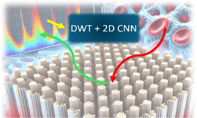 Highly Accurate And Robust Early Stage Detection Of Cholangiocarcinoma Using Near Lossless Sers