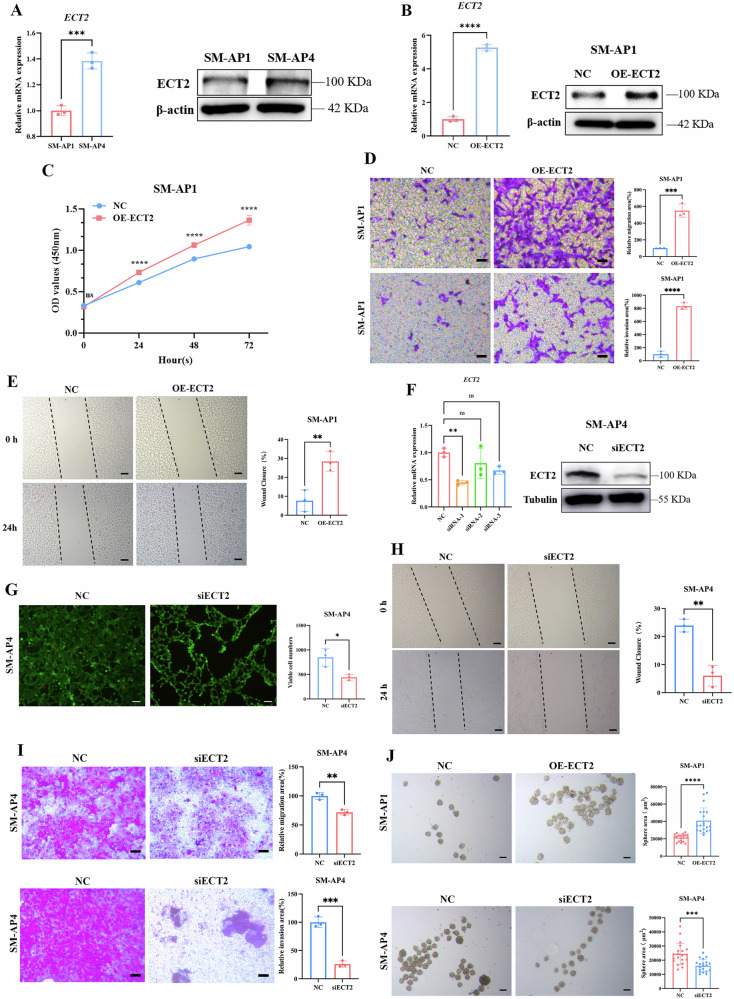 ECT2+ cell group acts as cancer stem cell in malignant pleomorphic adenoma - PMC