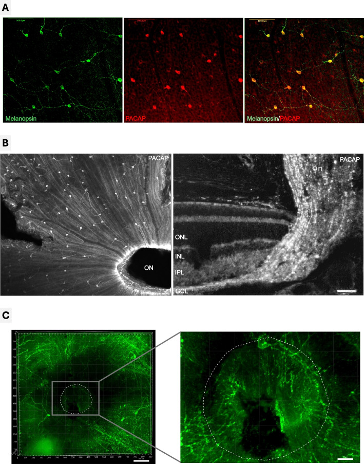 Blue light stimulation of the blind spot in human: from melanopsin to clinically relevant ...