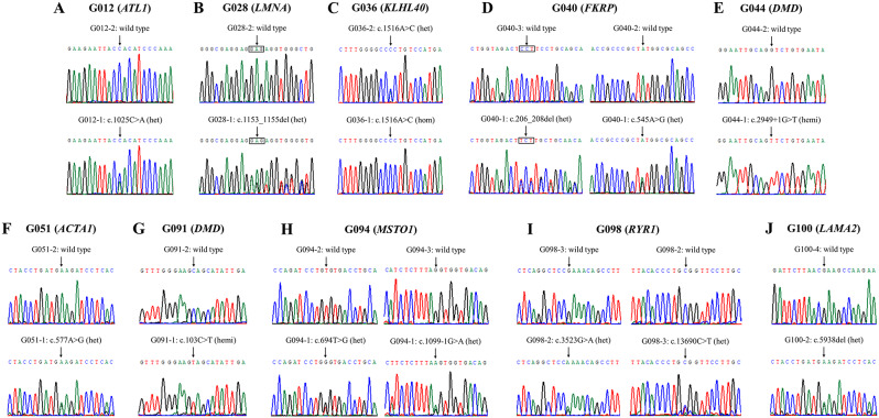 Congenital muscular dystrophies and myopathies: the leading cause of genetic muscular disorders ...