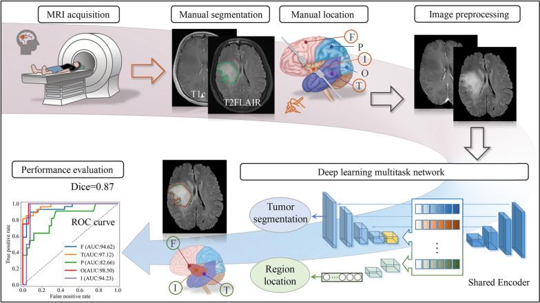 A transformer-based multi-task deep learning model for simultaneous infiltrated brain area ...