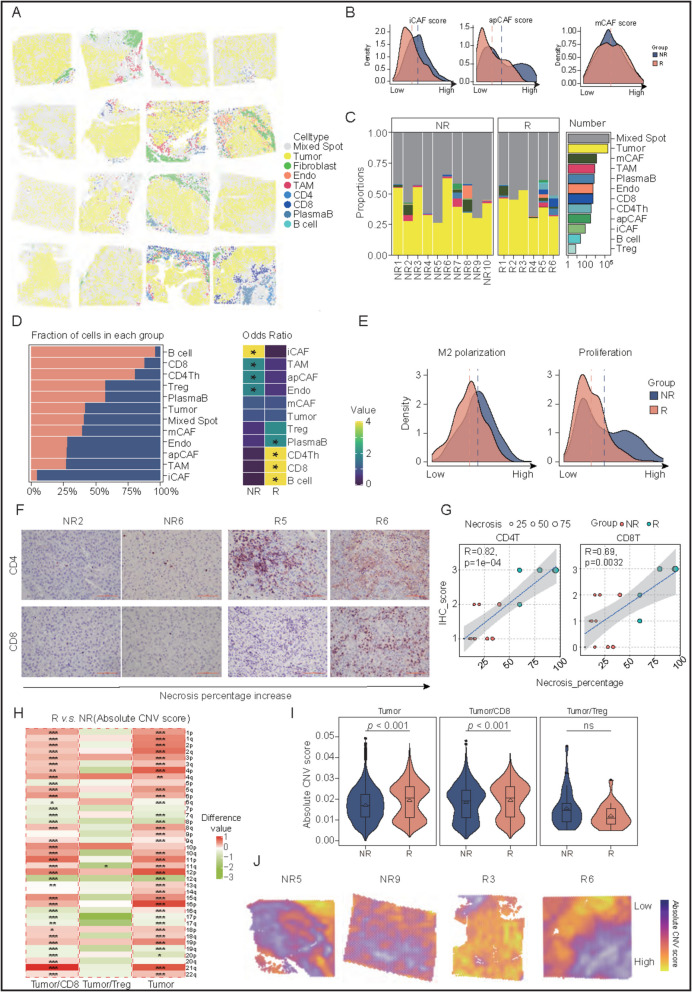 Multimodal sequencing of neoadjuvant nivolumab treatment in hepatocellular carcinoma reveals ...