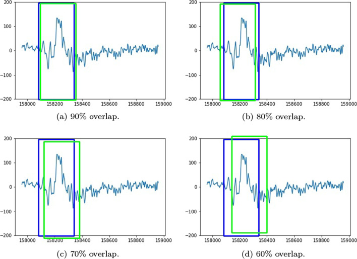 Detection of K-complexes in EEG waveform images using faster R-CNN and deep transfer learning - PMC