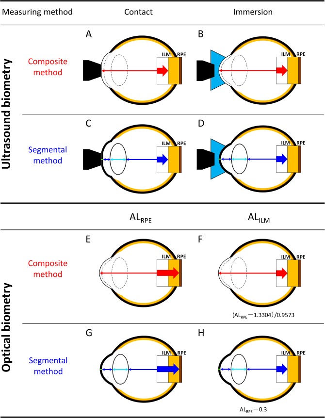 Comparison of composite and segmental methods for acquiring optical axial length with swept ...