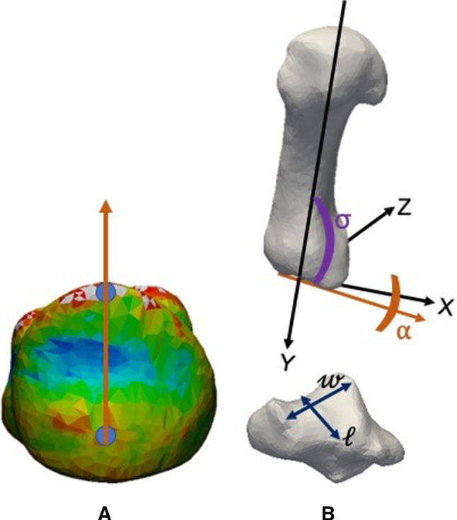 Statistical shape modelling of the first carpometacarpal joint reveals high variation in ...