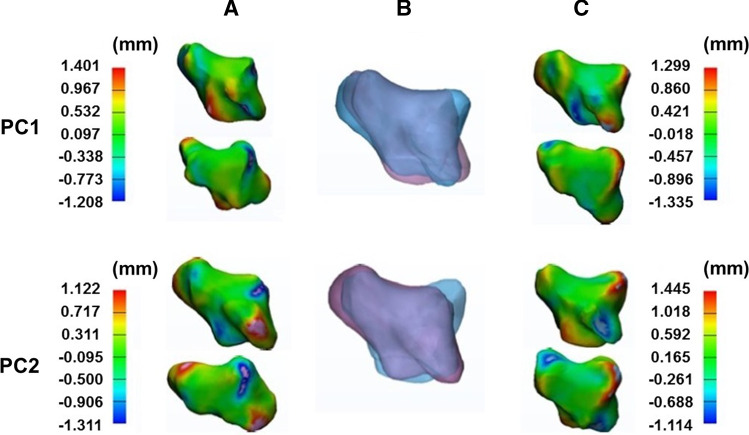 Statistical shape modelling of the first carpometacarpal joint reveals high variation in ...