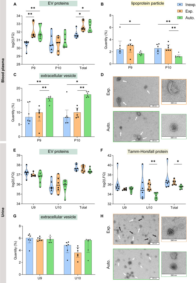 Integrating automated liquid handling in the separation workflow of extracellular vesicles ...