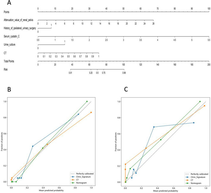Early diagnostic model of pyonephrosis with calculi based on radiomic features combined with ...