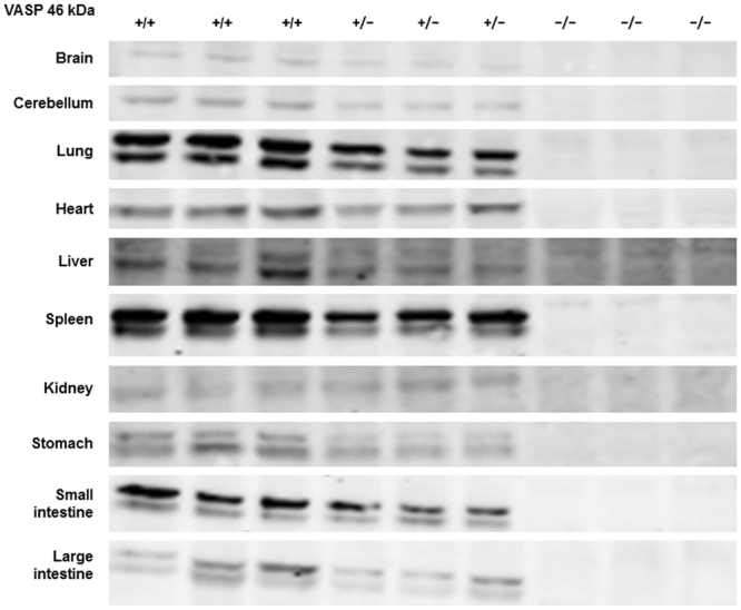 Vasodilator-stimulated phosphoprotein (VASP) is not a major mediator of platelet aggregation ...