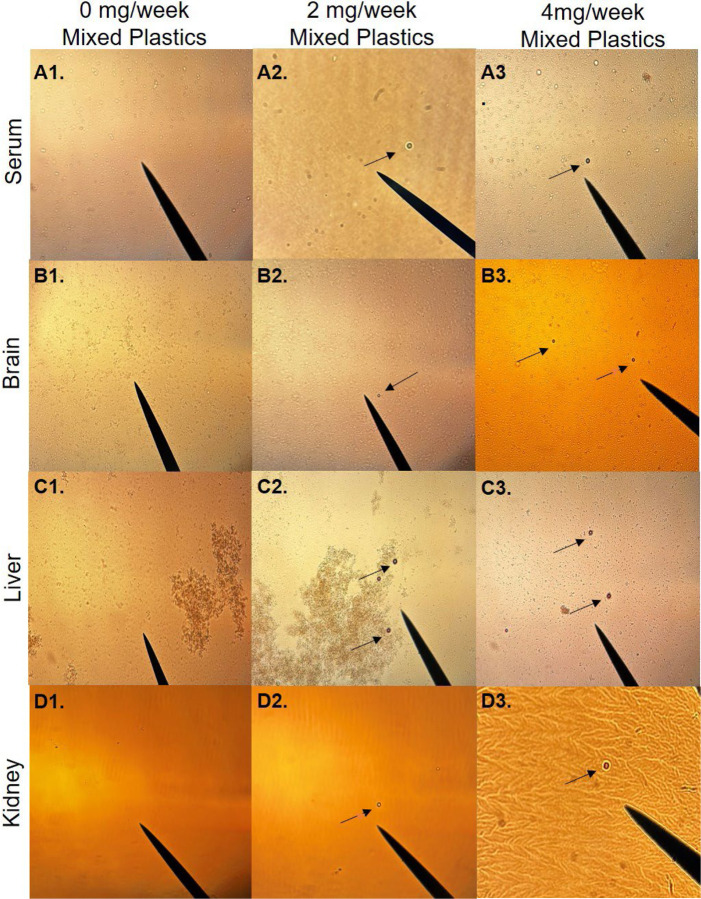 In Vivo Tissue Distribution Of Microplastics And Systemic Metabolomic
