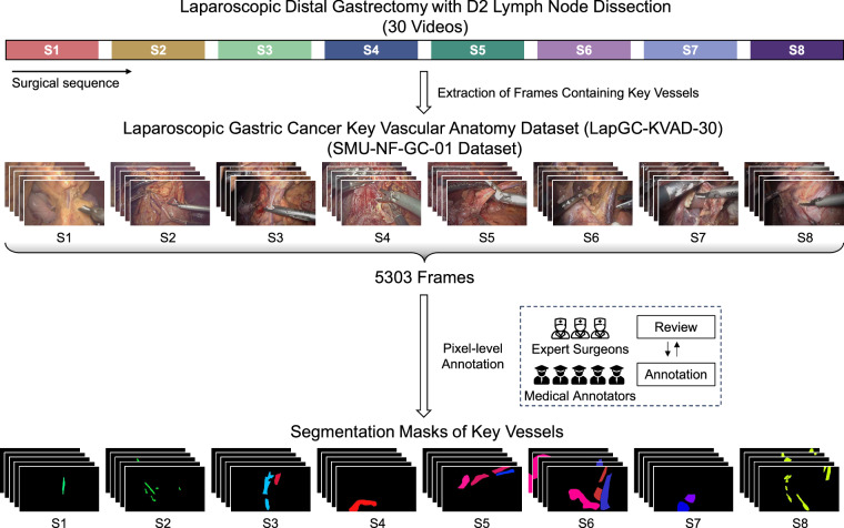 Dynamic key vascular anatomy dataset for D2 lymph node dissection during laparoscopic gastric ...