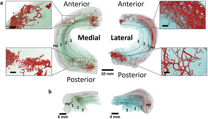 Revealing the complexity of meniscus microvasculature through 3D visualization and analysis - PMC