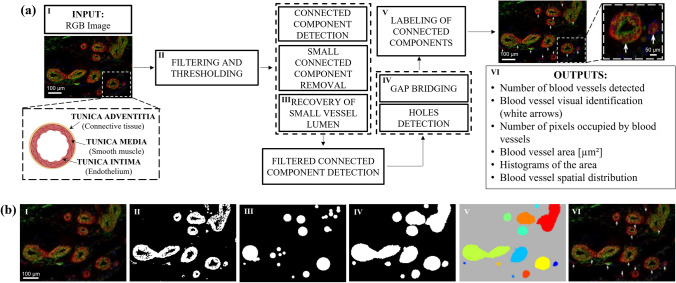 Blood Vessel Detection Algorithm for Tissue Engineering and Quantitative Histology - PMC