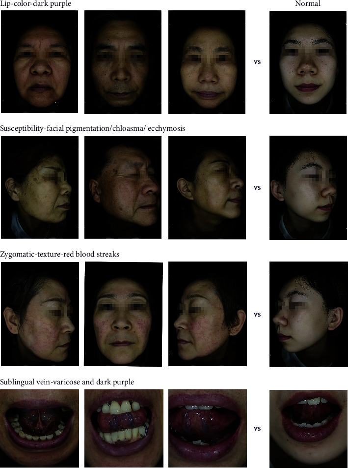 Traditional Chinese Medicine Constitution Identification Based on ...